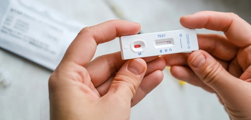 “El uso de los autotest para covid va a generar muchos problemas ...